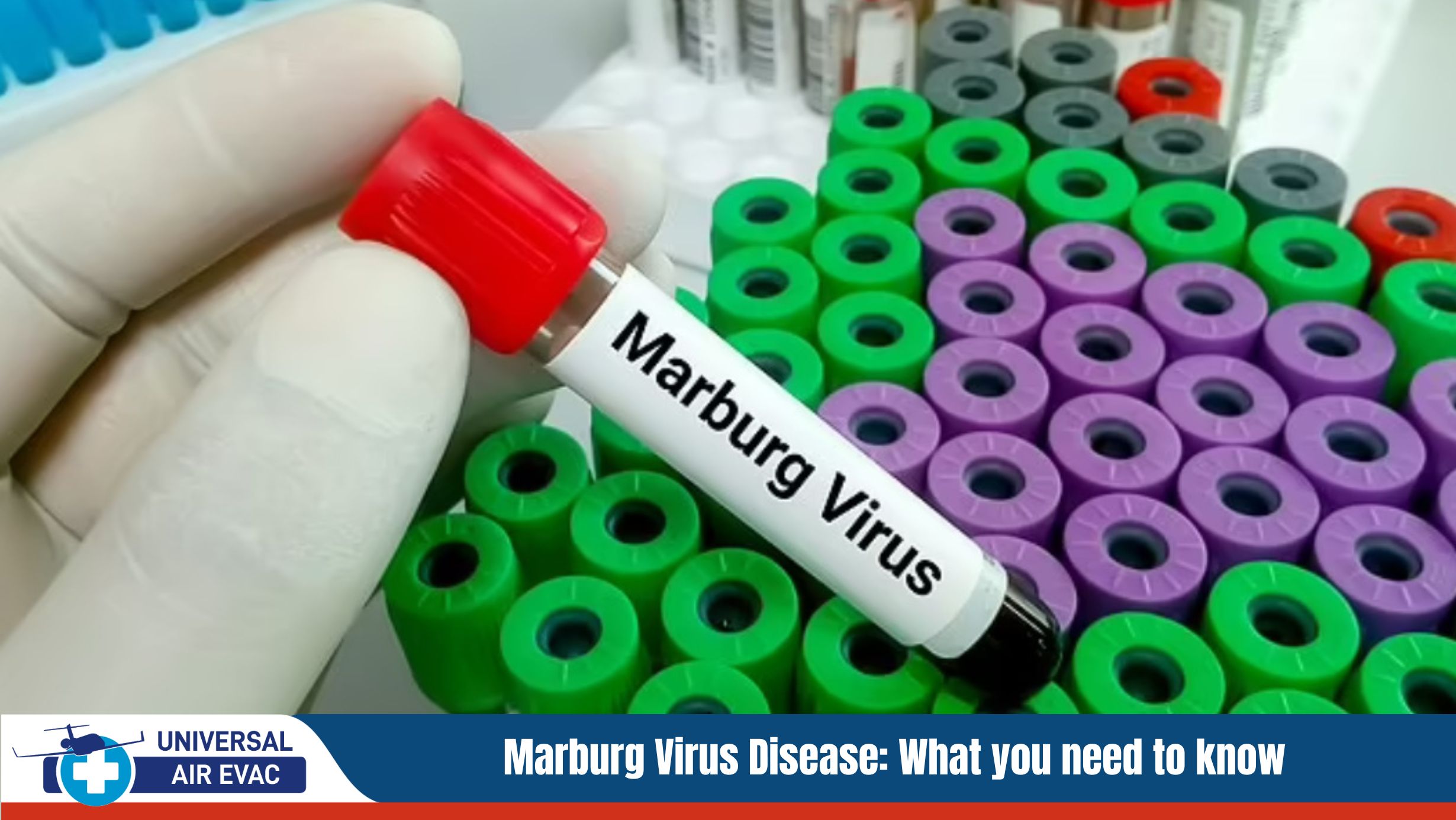 Understanding Marburg Virus Disease: What You Need to Know | Universal Air Evac
